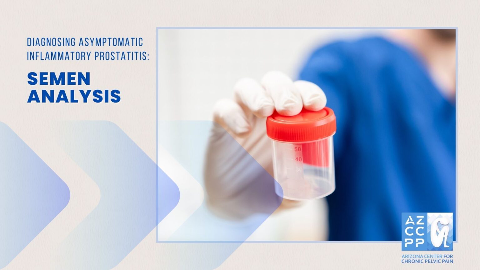Diagnosing AIP in Men: Semen Analysis | Pelvic Pain Doctor